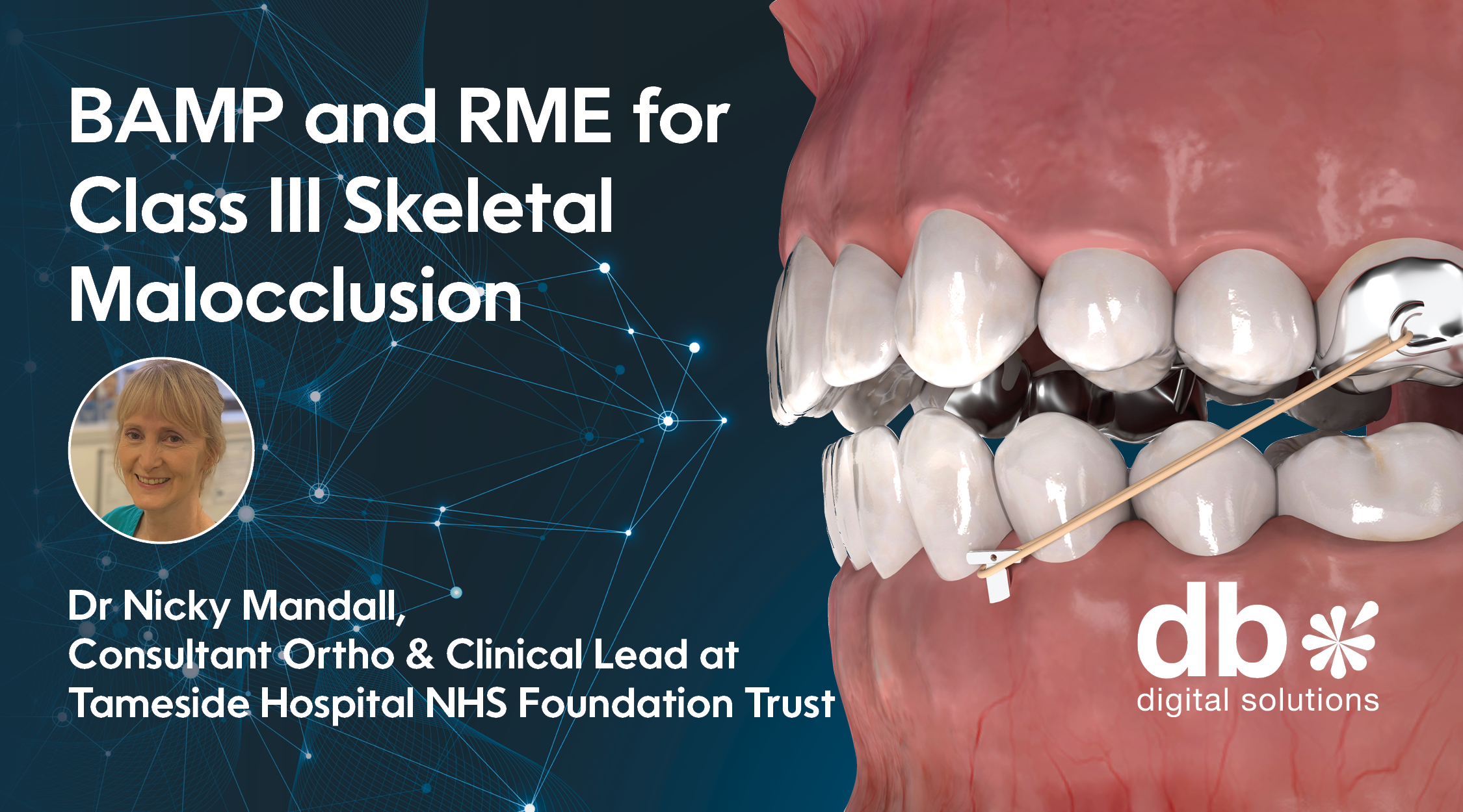 Dr Nicky Mandall: What is the Impact of BAMP and RME on Class III Skel ...