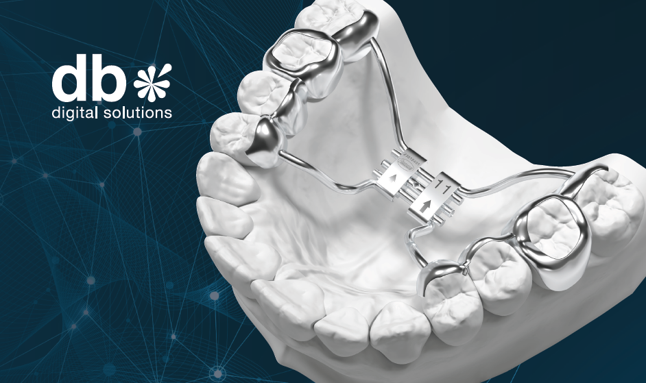 What Digital Innovations are Transforming Orthodontics? DB Digital Sol ...