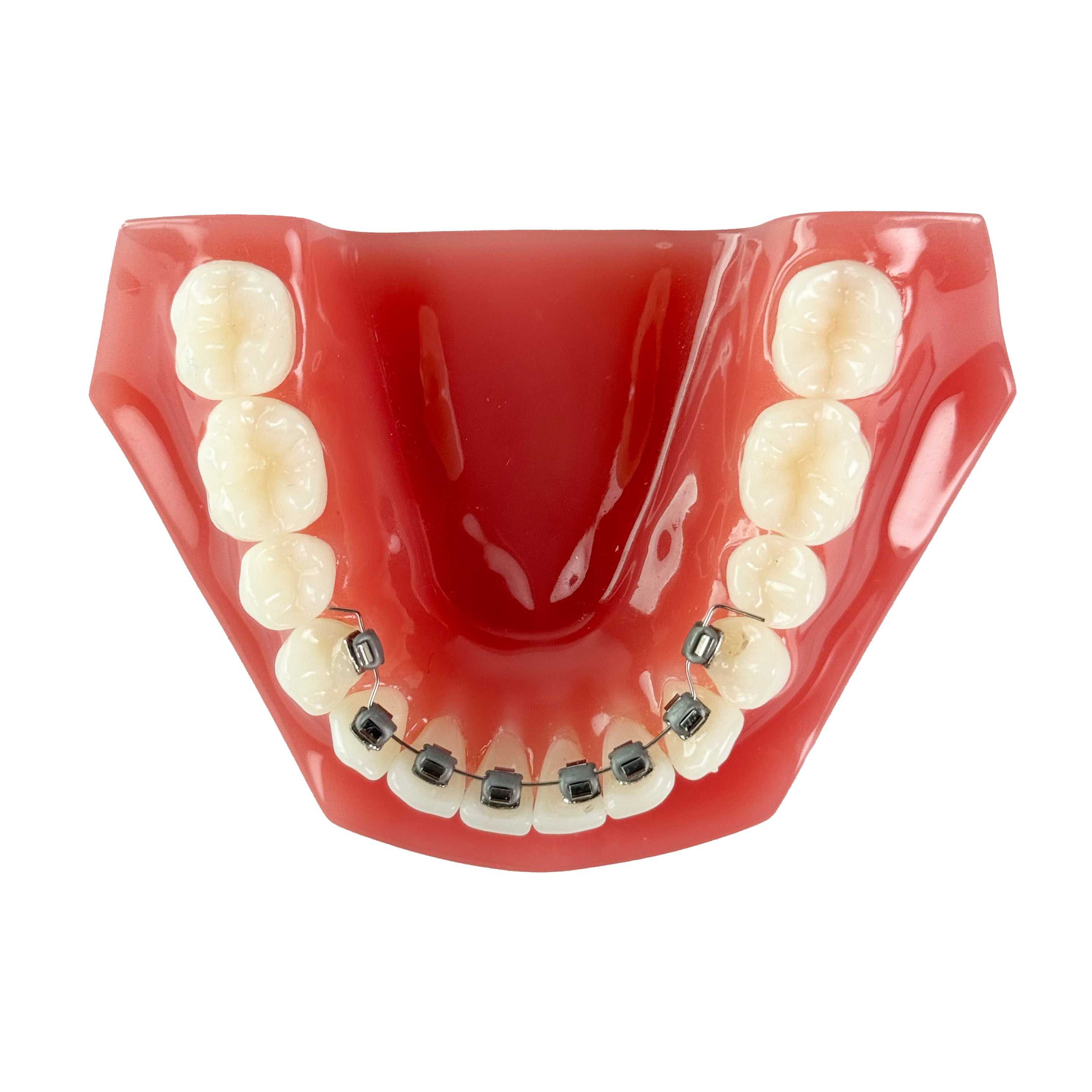 Ideal Lingual Consultation Model – DB Orthodontics Limited
